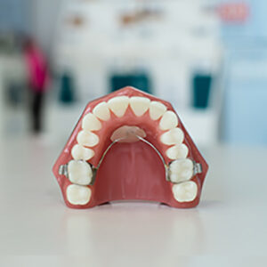 Other Treatments - DuClos Orthodontics